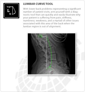Lumbar curve tool - ChiroSight Digital X-Ray Solutions